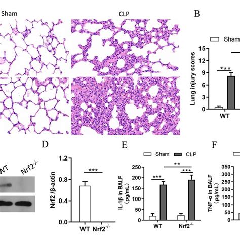 Nrf2 Deficiency Exacerbates Sepsis−induced Ali And Promotes