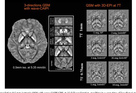 Figure 1 From Pulse Sequences And Parallel Imaging For High