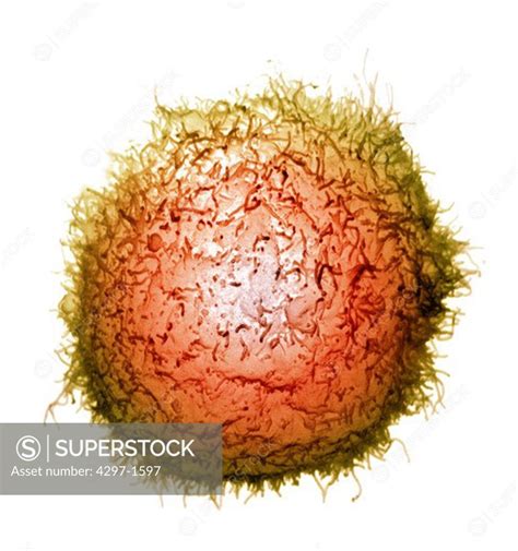 Scanning Electron Micrograph Of A Single Macrophage With Projectile