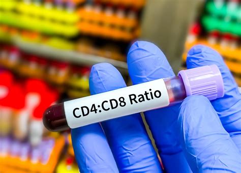 Decreased Cd4 Cd8 Ratio Linked To Increased Infections In Aav