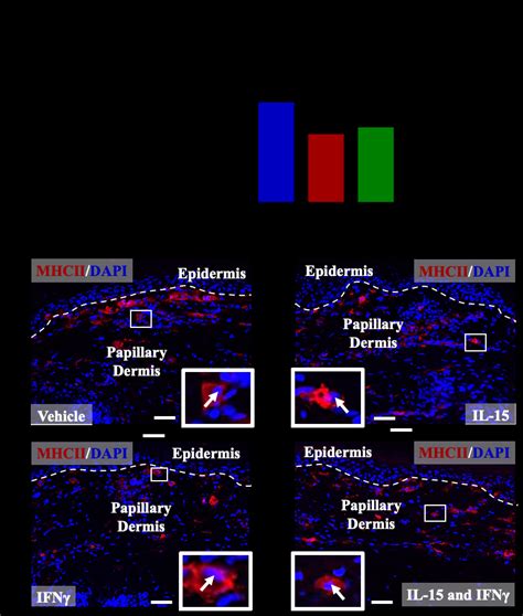 Ifnγ Significantly Downregulates The Number Of Mhcii Cells In The Ifnγ Significantly Downregulates The Number Of Mhcii Cells In The