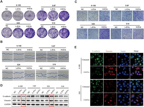 Uptake Of Evs Derived From Highly Metastatic Npc Cells Enhances Npc
