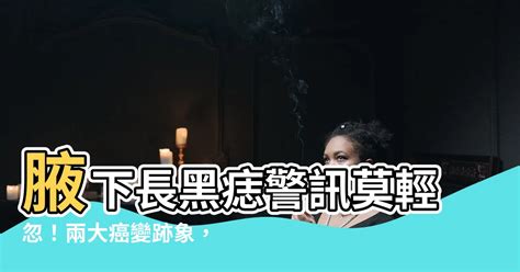 【腋下黑痣】腋下長黑痣警訊莫輕忽！兩大癌變跡象，你不能不知！ 每日新聞 Daily News Feeding