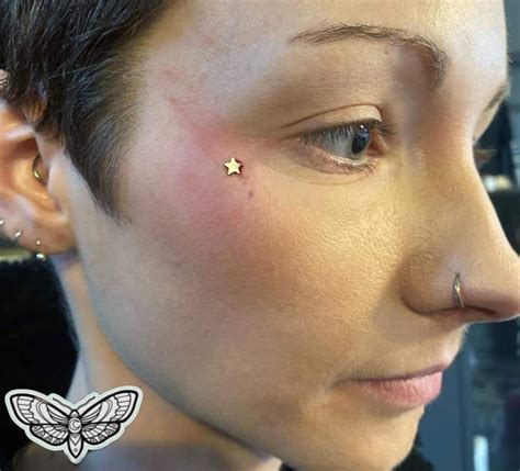 Cheek Piercing Scars Surface Piercing Scar Piercings E Cool Piercings