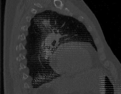 Visualization Of The 3d Motion Field Of The Lung Here The Lung Motion