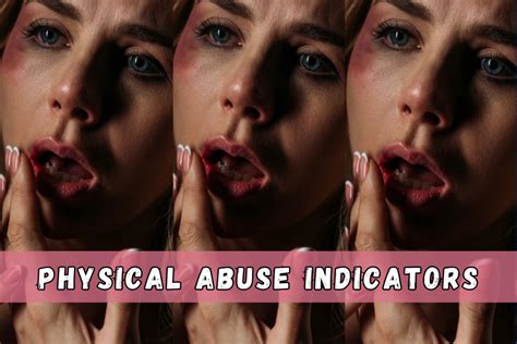Unmasking The Truth Key Physical Abuse Indicators In Relationships