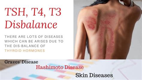 Tsh T4 T3 Normal Range 6 Helpful Things You Need To Know Right Now Biowellbeing