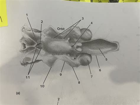 Chondrocranium Dorsal View Shark Diagram Quizlet