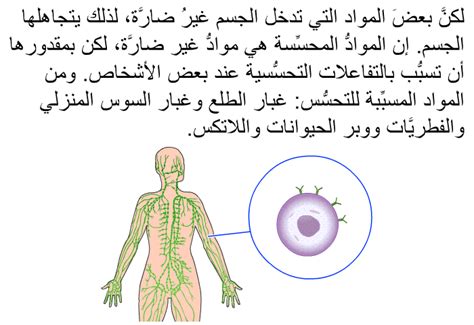 التحسس من اللاتكس