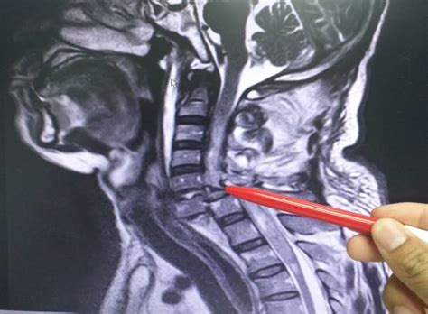 1500개 이상의 채찍질손상 스톡 사진 그림 및 Royalty Free 이미지 Istock