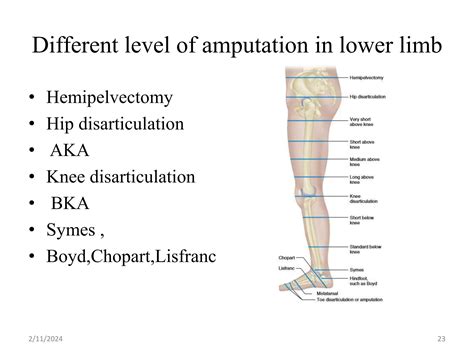 Lower Limb Amputation Pptx
