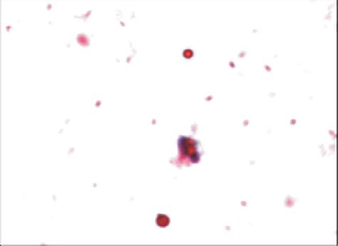The Slide Of Teased Ovary From Wolbachia Mosquito Did Not Show Any