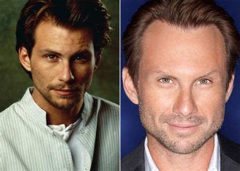 Christian Slater Before And After Plastic Surgery Face Hair Botox
