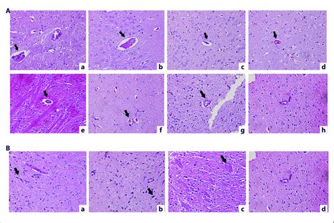Hematoxylin And Eosin Staining Results In Rat Cortical Area After