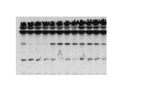 The Sphk2 Activity In A202j Cells Was Inhibited By Sg 12 A202j Cells