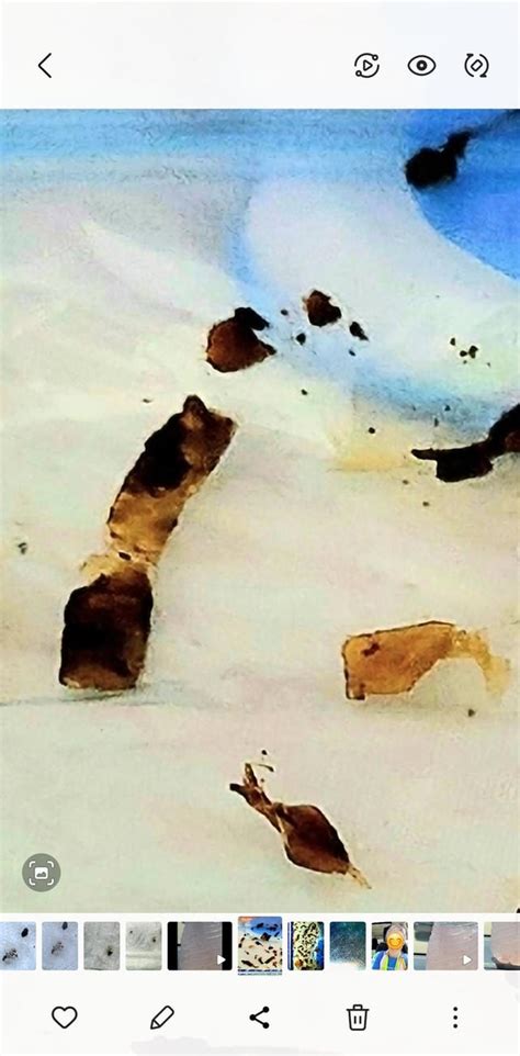 Are These Tapeworm Proglottids Segments Rdiagnoseme