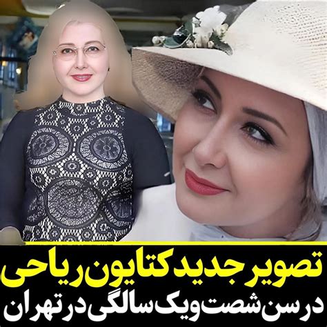 کتایون ریاحی 30 سال جوانتر شد عکس بعد از عمل زیبایی ترکیبی صورت