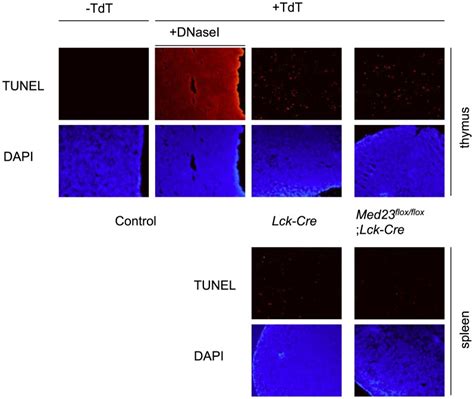 Tunel Assay Was Performed On Cryosections From Thymus And Spleen Of