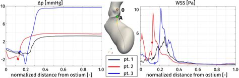 Frontiers Image Based Computational Hemodynamics Analysis Of Systolic Obstruction In