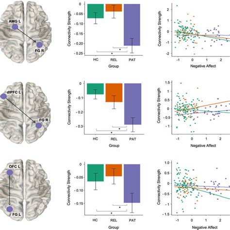 Disease Related Alterations In Effective Connectivity The Middle Panel