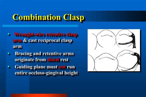 Ppt Principles Of Rpd Design Powerpoint Presentation Free Download