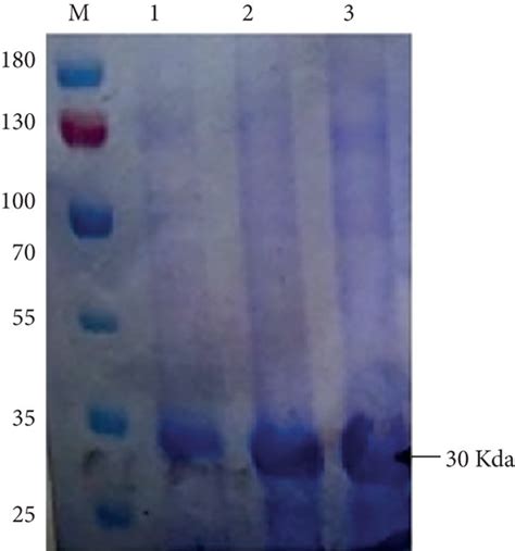 Sds Page Of The Purified Fractions Of Lectin Protein From Lepidium Download Scientific Diagram