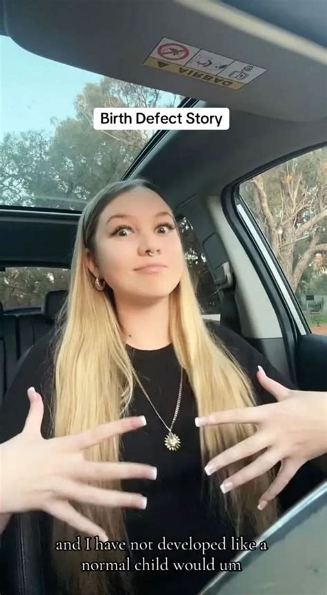 자궁 없이 태어나 생리 안 해본 21세 여성 임신 꿈꾸게 한 비결은