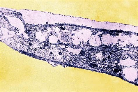 Fda Approves The First Syphilis Test For Use At Home Internewscast Journal