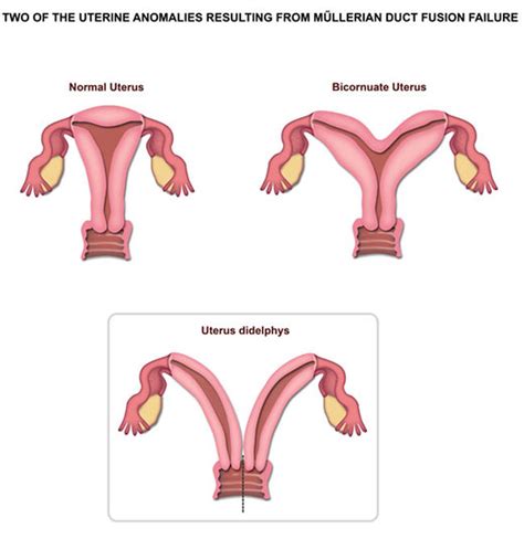 Meet The Woman That Has 2 Vaginas 4 Pics