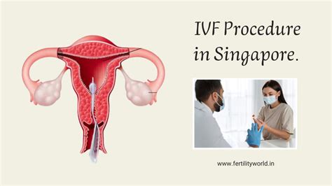 Fertility Treatment In Singapore Ivf Cost In Singapore Fertilityworld