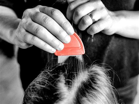 What Types Of Lice Medication Are Available