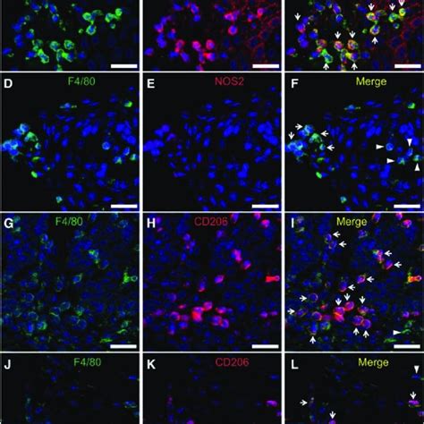 Two Color Immunofluorescence For M1 And M2 Macrophages In The
