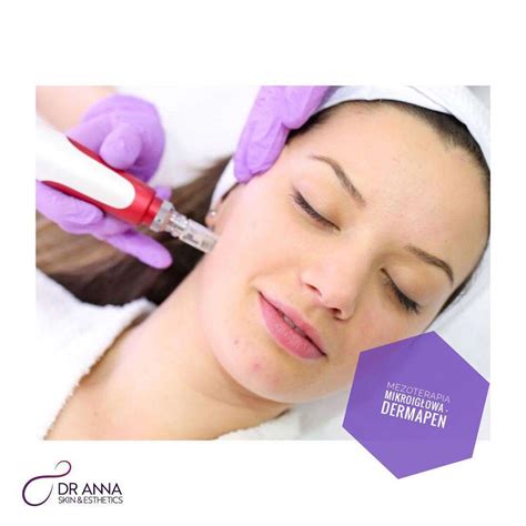 Mezoterapia mikroigłowa DERMAPEN Dr Anna Skin Esthetics