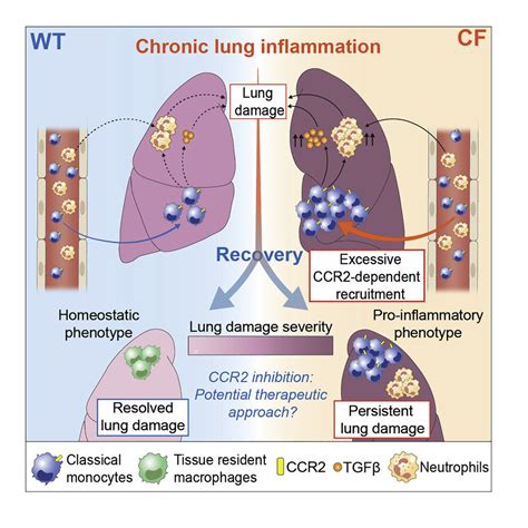 Cystic Fibrosis Lungs Diagram