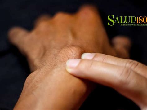 ¿qué Es Un Sarcoma