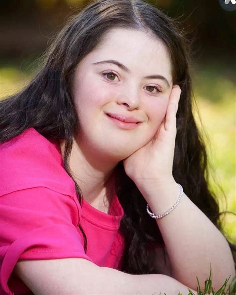 First Downs Syndrome Model Ellie Goldstein Who Campaigned For Gucci