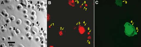 Specific Expression Of Reporter By The Rev Dependent Lentiviral Vector
