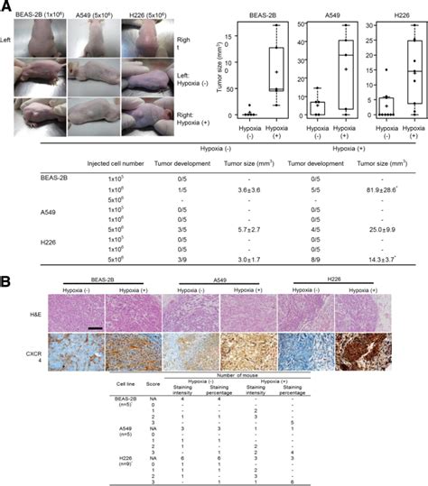 Hypoxia Induced Cancer Stemness Acquisition Is Associated With Cxcr4