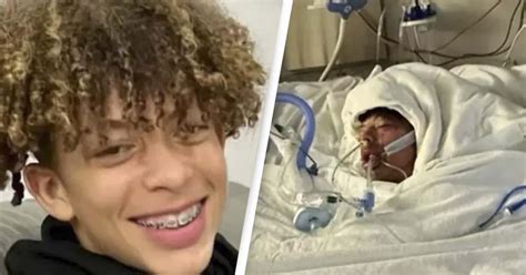Tiktok Challenge Leaves Teen With Burns On 75 Of His Body Secret