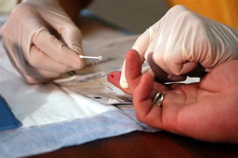 Same Day Hiv Testing Treatment Improves Outcomes For Patients