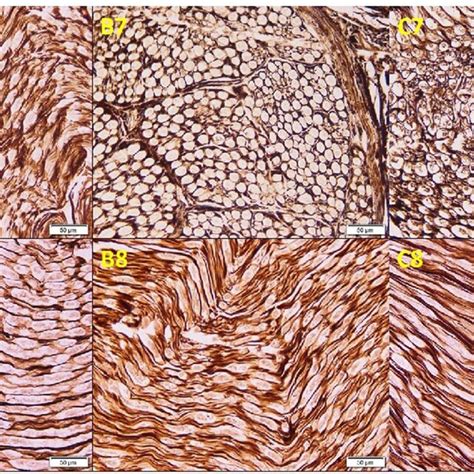 Photomicrographs Of Transverse Sections In Cadaveric Median Nerve