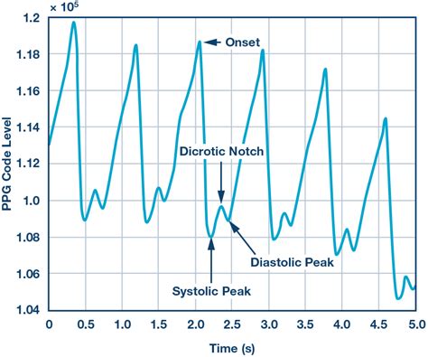Music Based Algorithm For On Demand Heart Rate Estimation Using