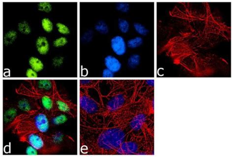 Neun Recombinant Monoclonal Antibody 14h6l24 702022