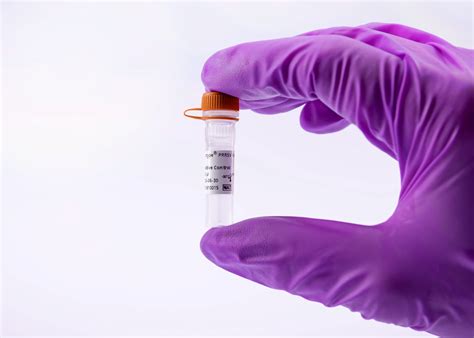 Indical Bioscience Virotype Prrsv Pro Positive Control 30 Reactions Online Shop