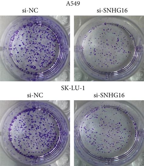 Snhg16 Repression Reduced The Viability Of Lung Cancer Cells Through