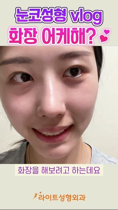 눈코성형 브이로그 13일차 Youtube