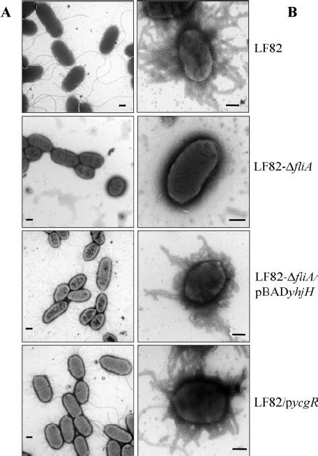 Electron Microscope Bacteria