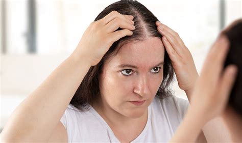 Hair Loss Can Be Caused By Overactive Or Underactive Thyroid Says