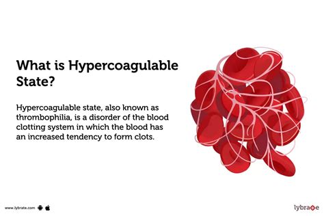 Hypercoagulable State Causes Symptoms Treatment And Cost