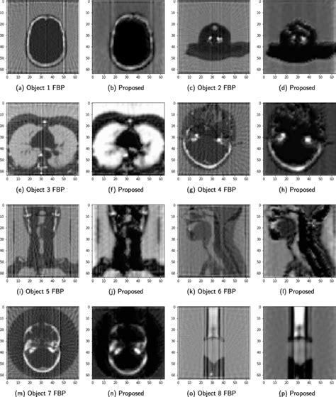 reconstructed images from 40 projection views using transform based
